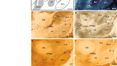 A Sagittal Atlas Map And B Photomicrographs Of Adjacent Sections