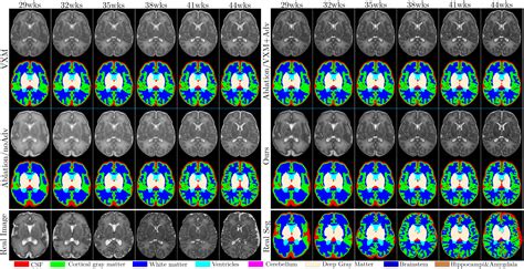 2021generative Adversarial Registration For Improved Conditional Deformable Templates