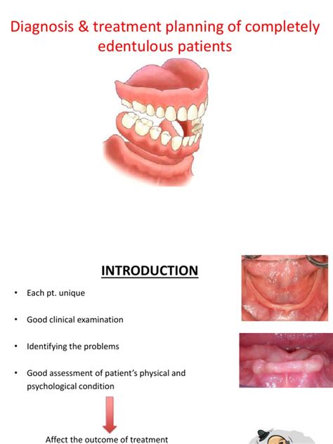 Diagnosis And Treatment Planning Of Completely Edentulous Patients Pdf