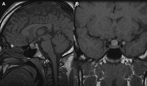Imaging Of The Pituitary Radiologic Clinics
