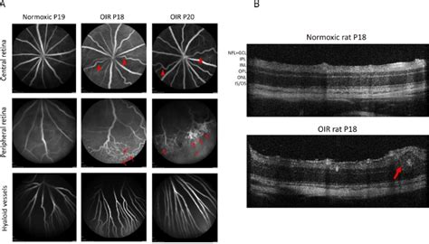 Oxygen Induced Retinopathy Model For Ischemic Retinal Diseases In Rodents Text Page