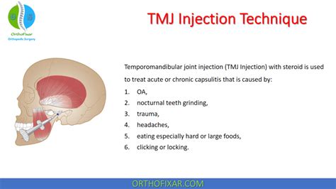 Tmj Injection Technique Easily Step By Step Orthofixar