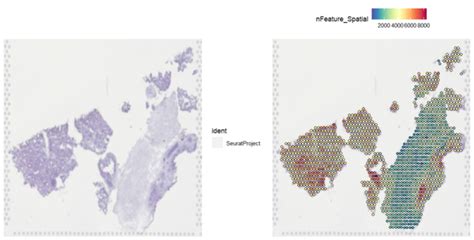空间转录组 Load10x Spatial函数修改适配多形式数据 空转标准流程 知乎