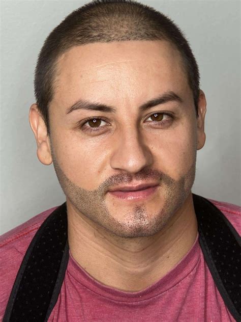 What Is Beard Micropigmentation Scalp Prodigy