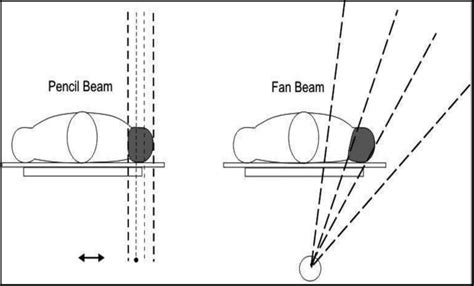 15 Pencil And Fan Beam Geometries Project The Same Roi Differently The