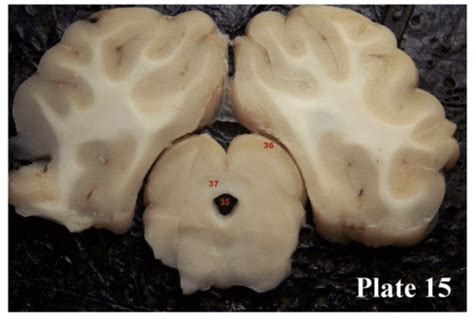 Coronal Cuts Plate 15 Flashcards Quizlet