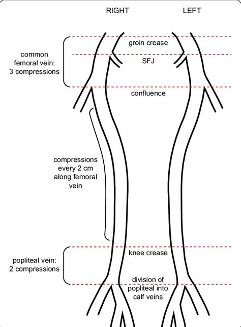 Lower Limb Venous Anatomy