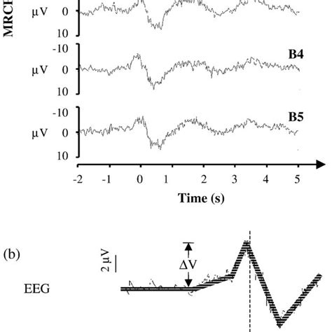 Mrcp Time Courses In A Subject A The Trigger Averaged Eeg Time