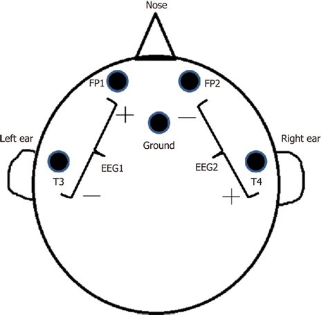 The Positions Of Five Electrodes On The Scalp Eeg Download Scientific Diagram