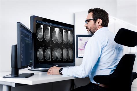 Structured Reporting Versnelt En Verbetert Verslaglegging Sectra Medical
