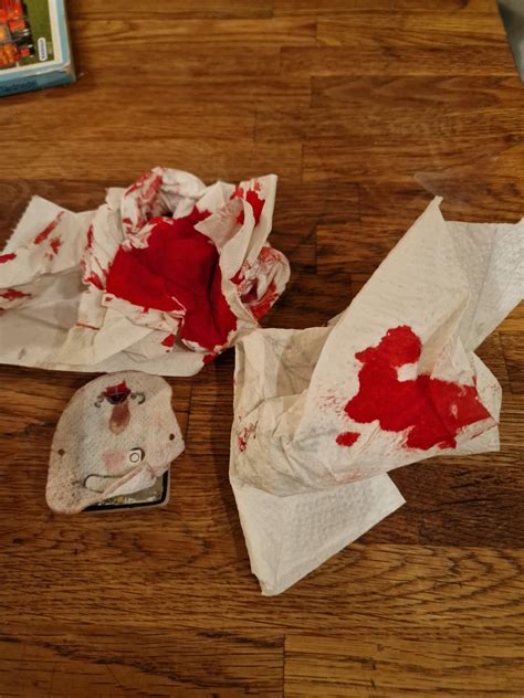 Dexcom Is A Relief R Type1diabetes