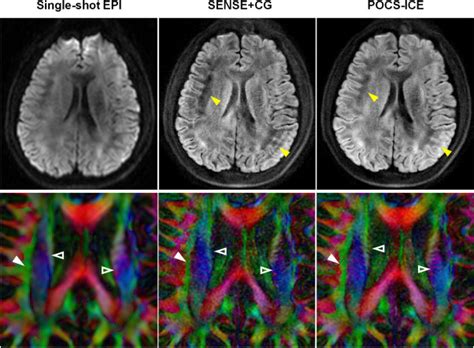 DWI Images Upper Row Of One Representative Direction And The Download Scientific Diagram
