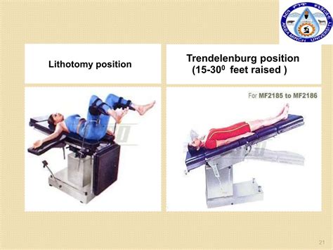 Special Radiographic Procedure Hysterosalpingographypptx