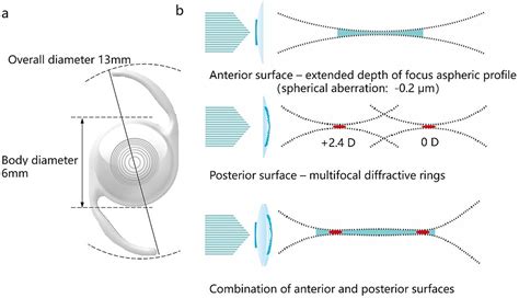 Frontiers Clinical Outcomes Of Effectiveness And Safety In Cataract
