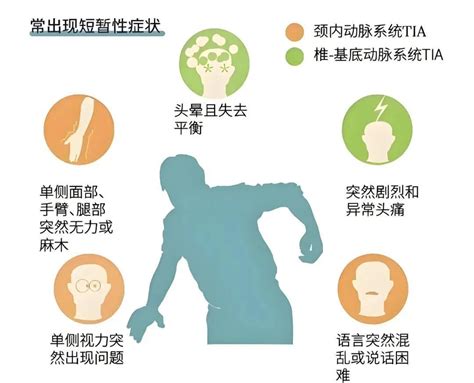 【每周科普】出现一过性肢体无力，如何办？ 脑医汇