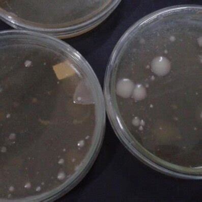 Bacterial Isolation Result Of Isolation From Bean Soaking Water Download Scientific Diagram