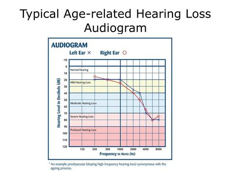 Ppt Hearing Loss Hearing Aids And Cochlear Implants Powerpoint