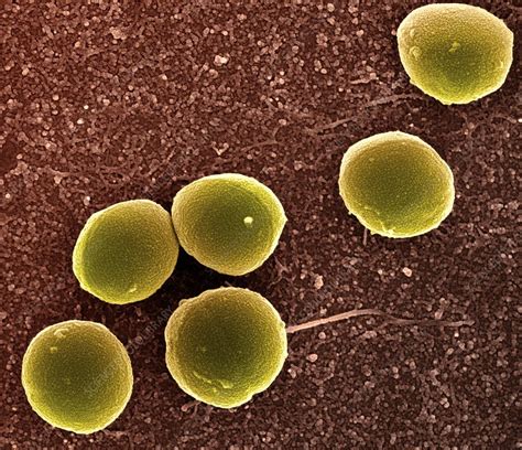 Staphylococcus Aureus Bacteria Sem Stock Image C013 4771 Science Photo Library