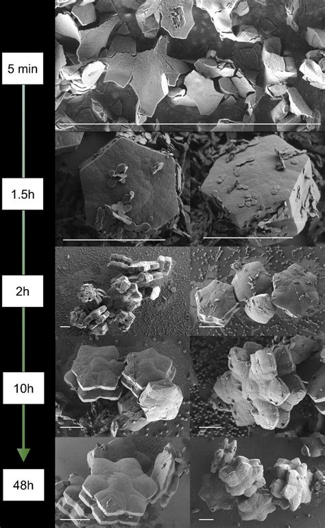 Scanning Electron Microscopy Sem Images Showing The Development Of