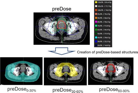Figure 1 From Evaluation Of Deep Learning Based Deliverable Vmat Plan Generated By Prototype