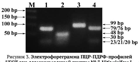 Electropherogram Of The Pcr Rflp Profiles Of Ufgt Gene Associated Group Download Scientific