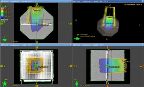 B Verification Plan Window In Eclipse Treatment Planning System For Download Scientific