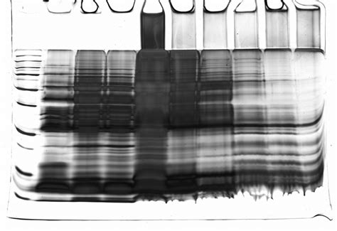 Shows That The Differential Extraction Remains Not Quantitative And Download Scientific Diagram