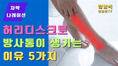 허리디스크로 방사통이 생기는 이유 5가지 Youtube