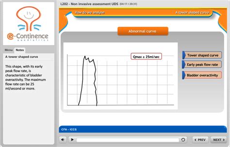 Equipment Uroflowmetry Urocap II And Urocap IV Innerstrength Healthcare