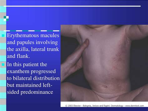 Ppt Viral Diseases Part Ii Powerpoint Presentation Free Download