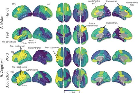 group source parcellation analysis of task‐imagery brain computer
