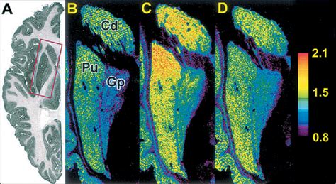 Figure 2 From Autoradiographic Mapping Of Dopamine D 2 ⁄d 3 Receptor