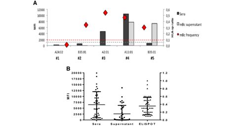 Comparison Of Hla Specific Ab Detection In Serum Supernatant Of Ex