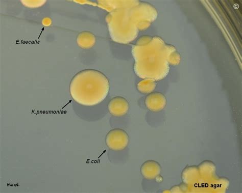 Klebsiella Pneumoniae Enterococcus Faecalis And Escherichia Coli On Cled Agar Lactose Positive