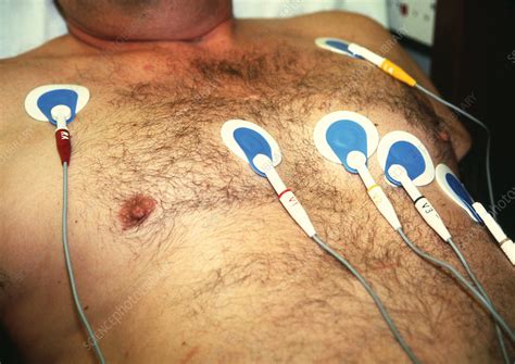 Ecg Electrodes Stock Image M460 0080 Science Photo Library