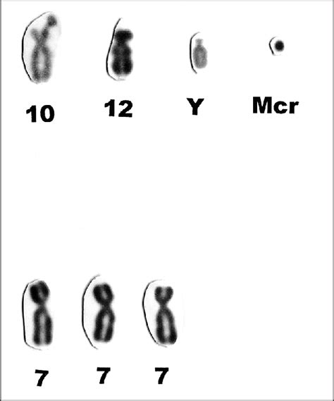 Marker Chromosomes Of Cell Line A2058 At 10 Th Passage Download