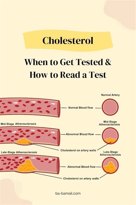 Cholesterol When To Get Tested And How To Read A Test High Cholesterol Remedies Cholesterol