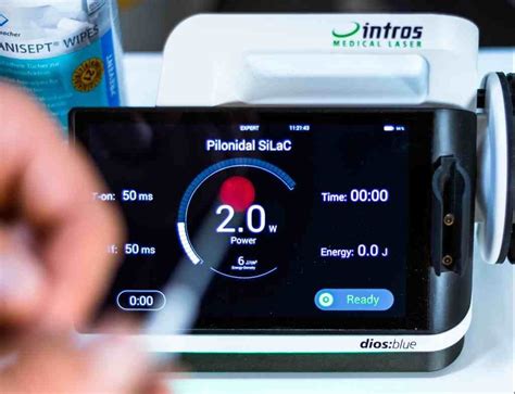 Pit Picking Sinusektomie Ambulant In Lokalanästhesie