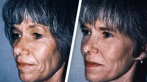 Identical Twins Show Astonishing Differences After One Had A Lot More