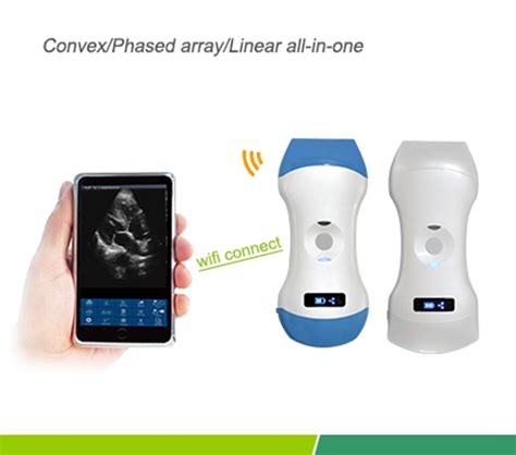 High Frequency Linear Array Ultrasound At Patricia Witcher Blog