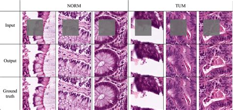 Restoration Results For Colon Pathological Images The Top Row Is Download Scientific Diagram