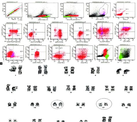 A Immunophenotypic Features By Flow Cytometric Analysis Revealed Cd45