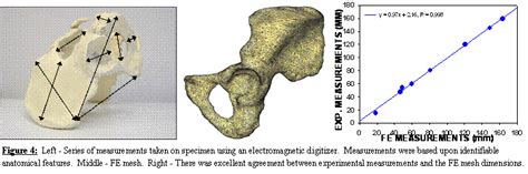 subject specific finite element modeling of hip joint
