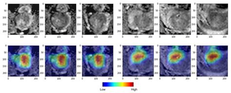 deep learning dl gradient weighted class activation mapping