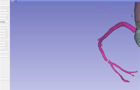 Automate Extract Centerline With Unconnected Segment Development 3d Slicer Community