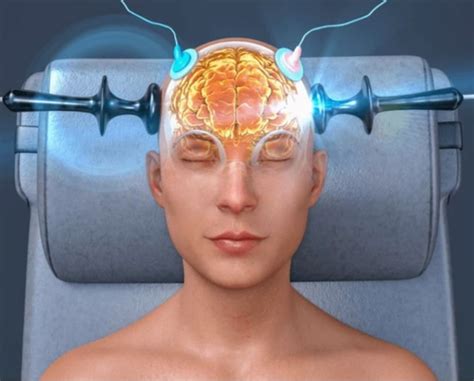 Ect Treatment In Hindi