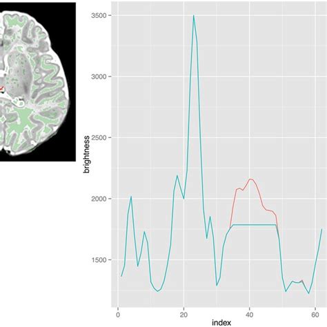Images From Phase 3 Morphological Filtering Via Reconstruction By Download Scientific Diagram