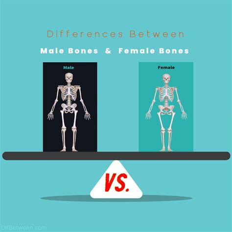 Male Vs Female Bones Key Structural Variations