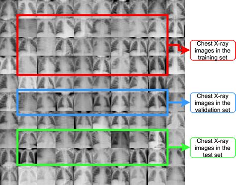 Figure 4 From An Enhanced Vision Transformer Model In Digital Twins Powered Internet Of Medical