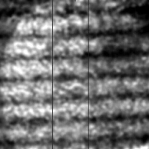 Difference Speckle Pattern Prior To The Action Of Lam On The Pc
